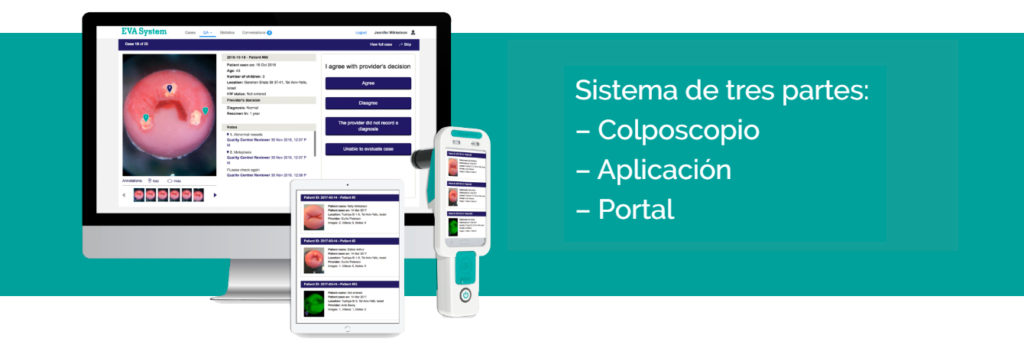 SISTEMA EVA (Evaluación Visual Avanzada) – El colposcopio inteligente