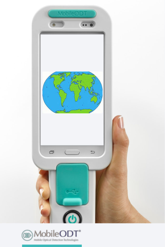 SISTEMA EVA (Evaluación Visual Avanzada) – El colposcopio inteligente